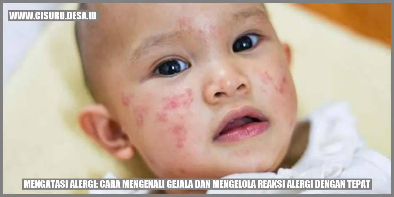 Mengatasi Alergi: Cara Mengenali Gejala dan Mengelola Reaksi Alergi ...